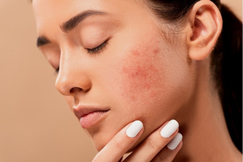 Google lance Derm Assist, une appli IA pour identifier les problèmes de ...